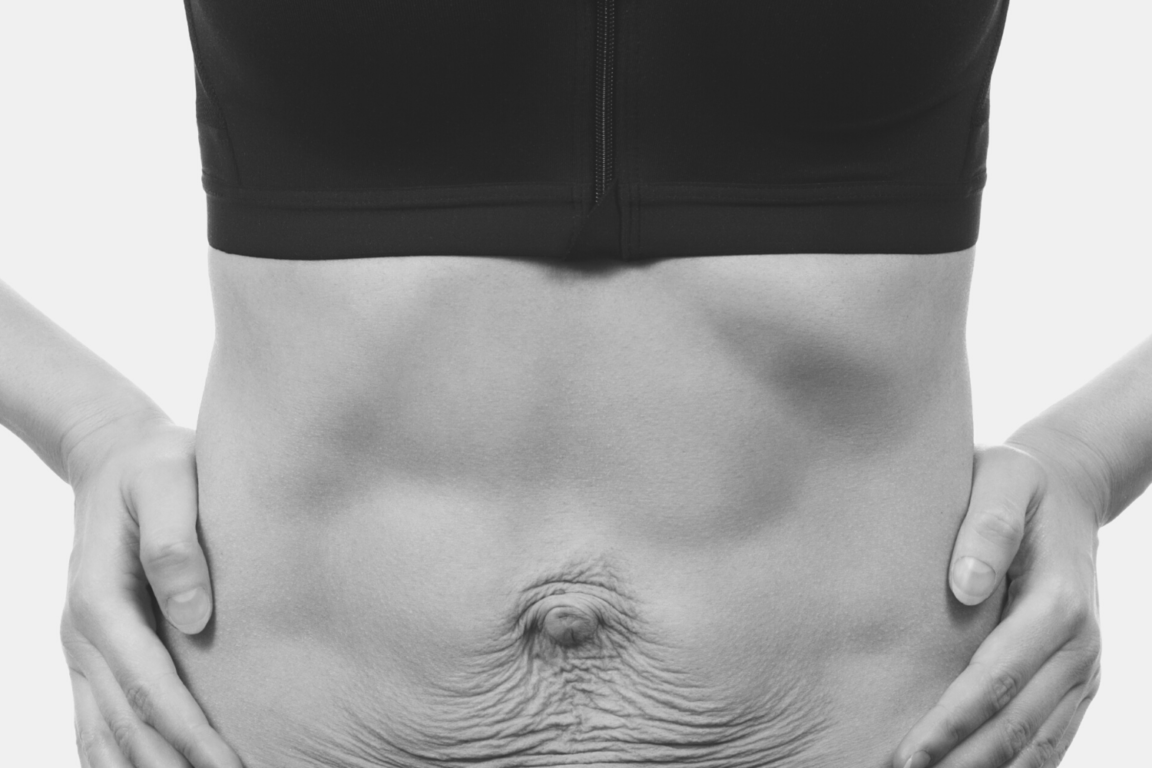 Blog - Bellyy | Diastasis Recti exercise program